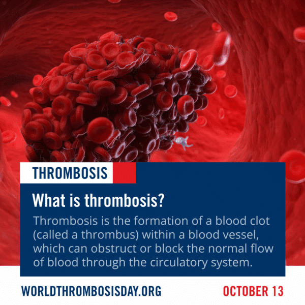 What is Thrombosis? - World Thrombosis Day